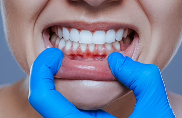 Get oral health advice at a community pharmacy near you