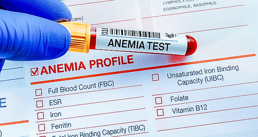 Find anaemia tests and support at a community pharmacy near you
